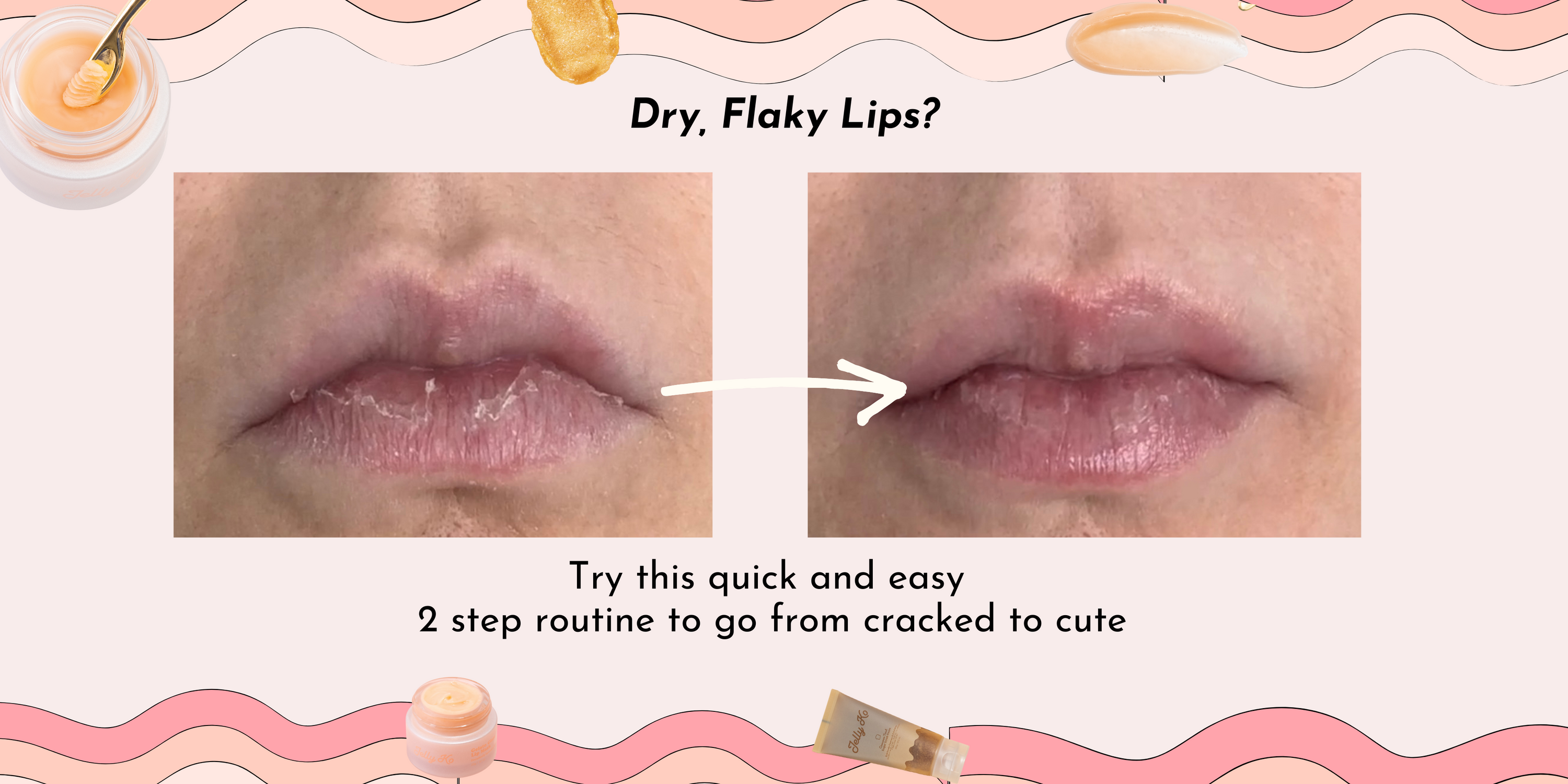 How to Fix Dry, Flaky Lips – jellyko