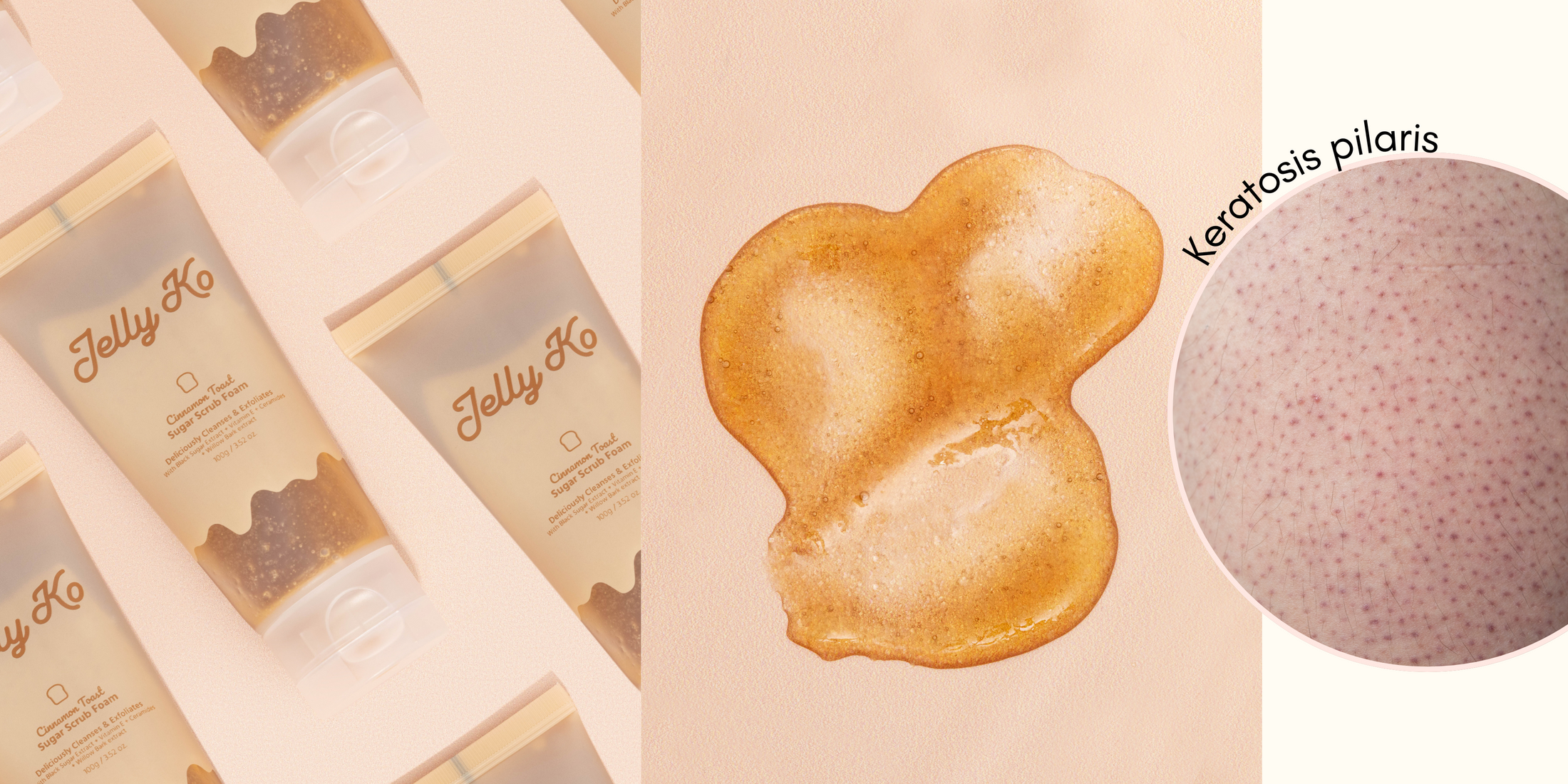K-Beauty Solutions for Chicken Skin – jellyko