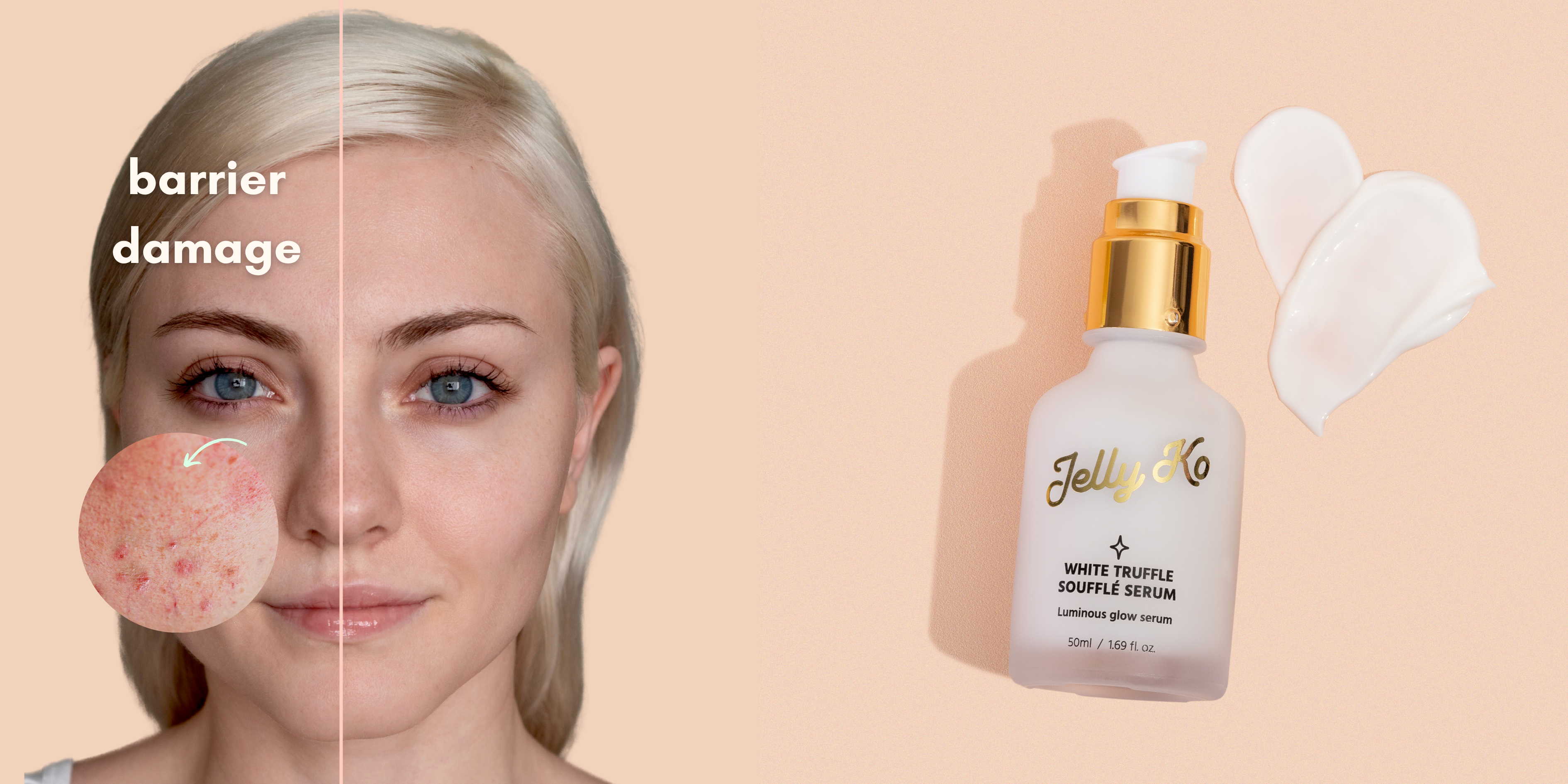 What To Do When You've Overdone It On Exfoliation – jellyko