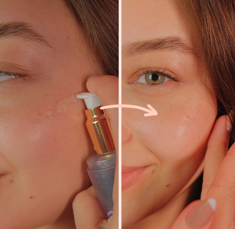 Skin Transformations – jellyko