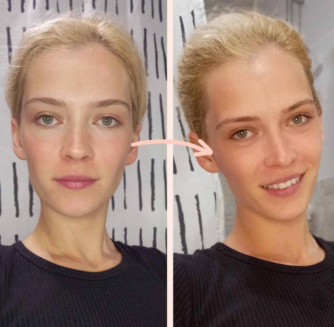 Skin Transformations – jellyko